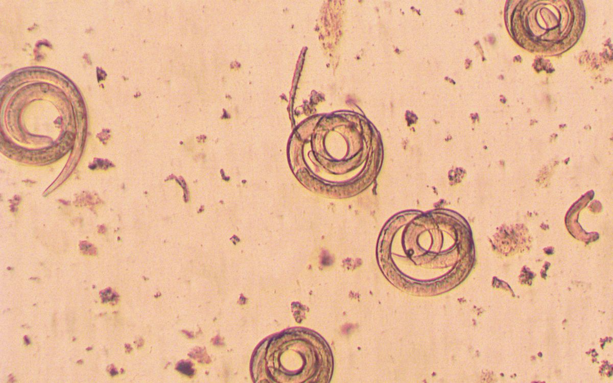 Prirodni lijek protiv parazita u tijelu - čišćenje i jačanje imunteta
