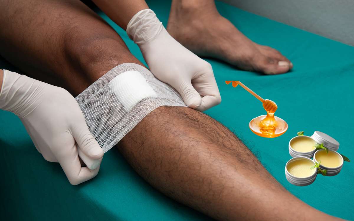 Dekubitus prirodno liječenje - šta pomaže kod rana od ležanja?