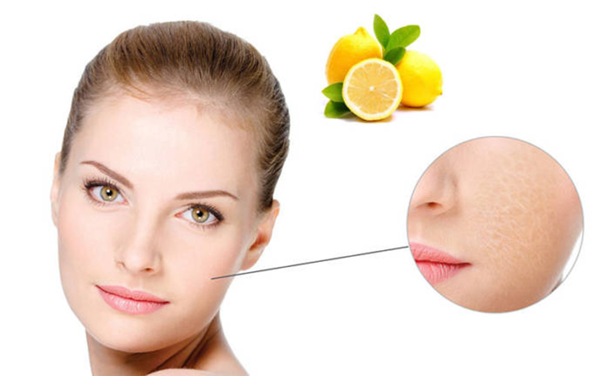 Kako ukloniti ožiljke od akni prirodnim putem - Narodni lijek