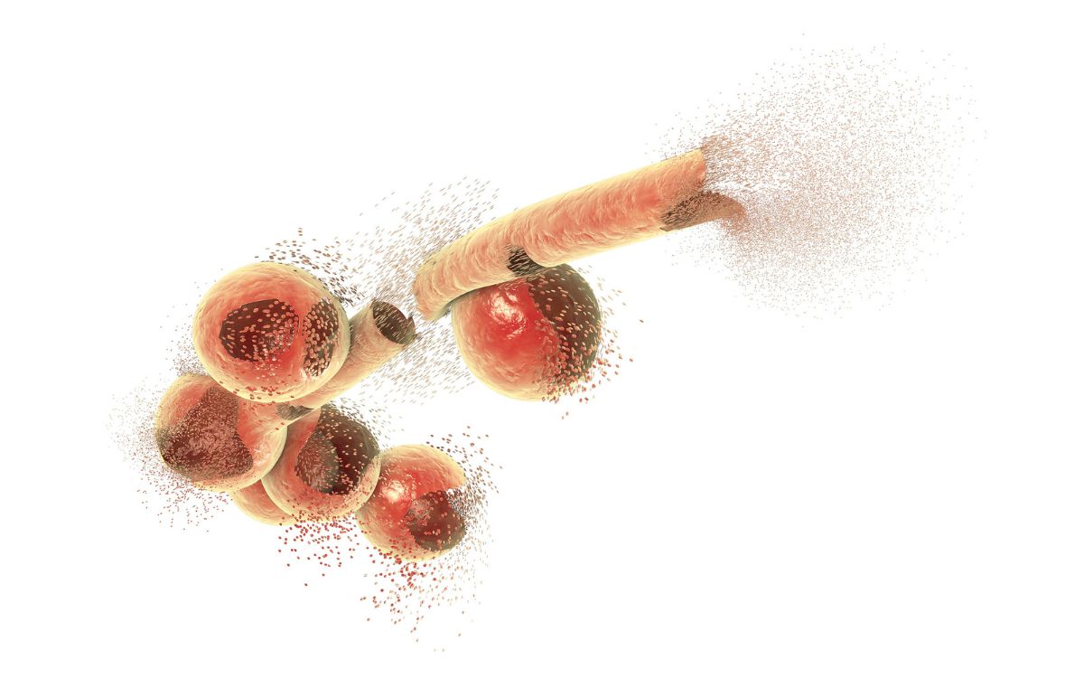 Kandida - simptomi - prenošenje - Najbolji lijek protiv kandide