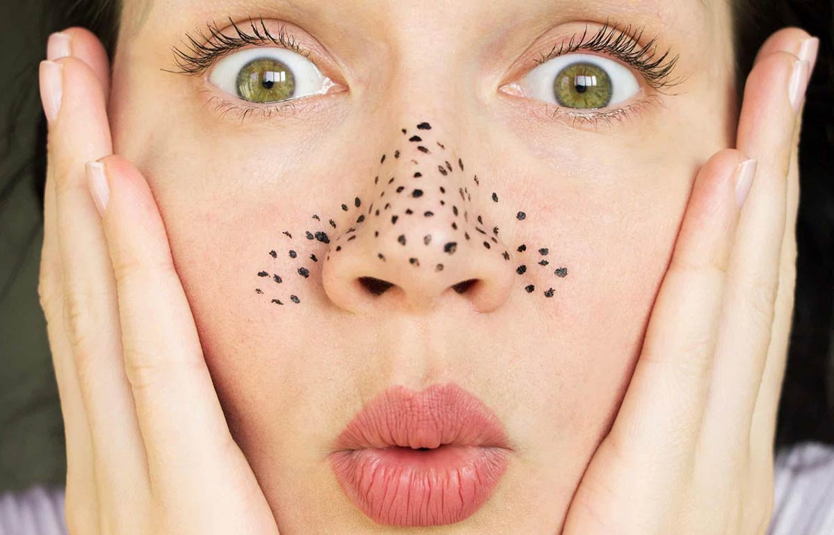 Prirodni lijek za mitesere - 4 domaća pripravka za uklanjanje mitesera