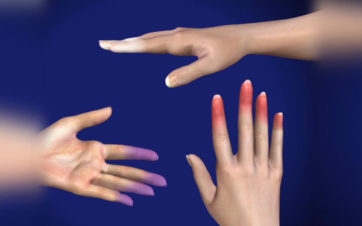 Modri prsti na rukama? Evo što to može značiti