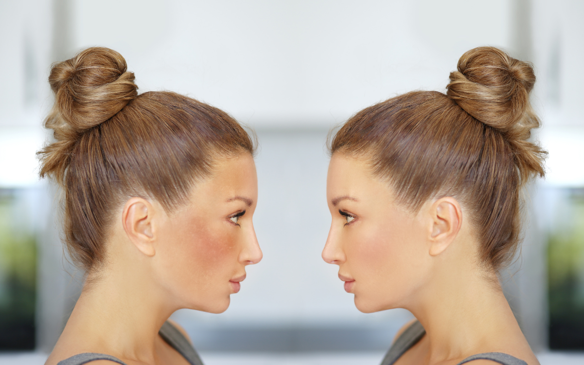 Petehije male crvene tačkice po tijelu kako liječiti i koliko traju?