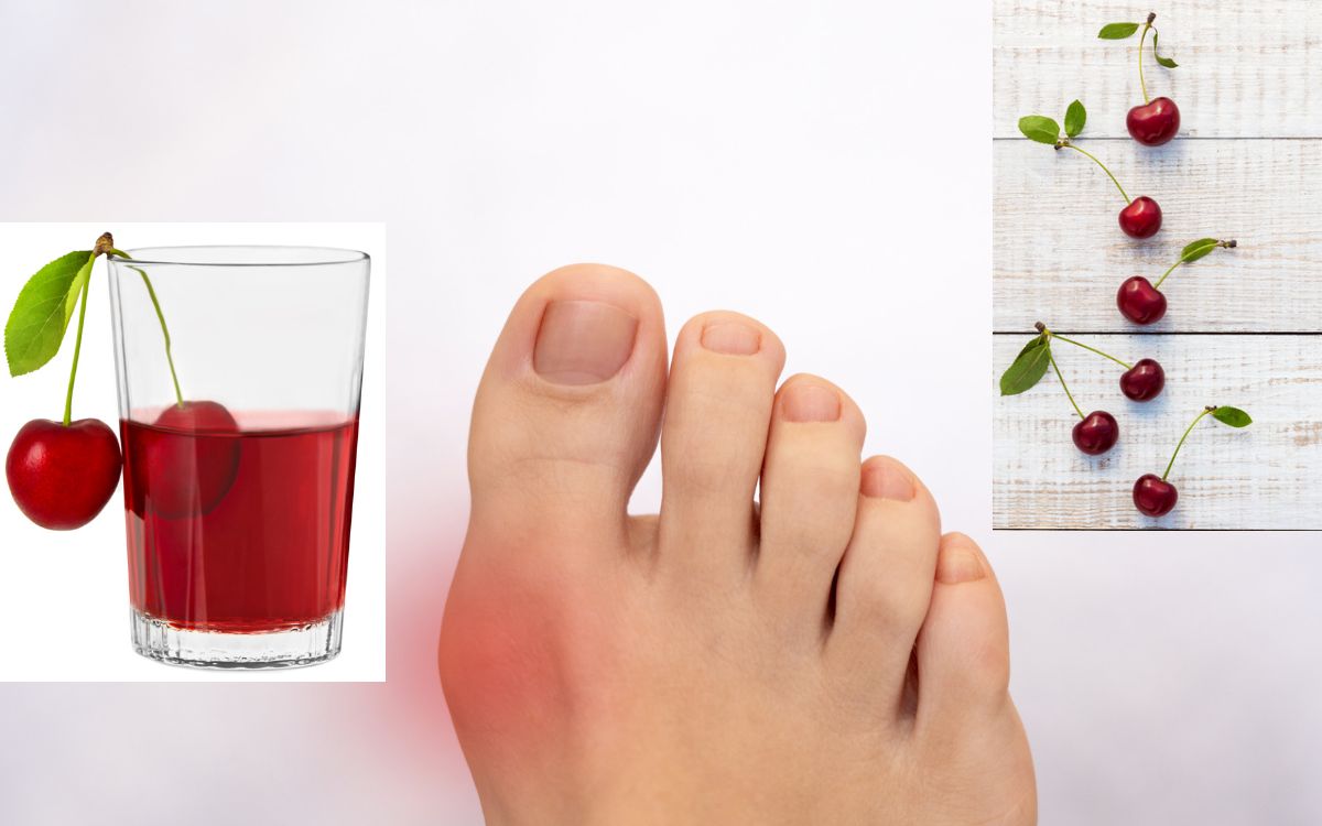 Trešnje i giht: Prirodni saveznik u olakšavanju simptoma
