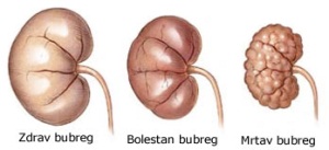 Bolest zatajenje bubrega